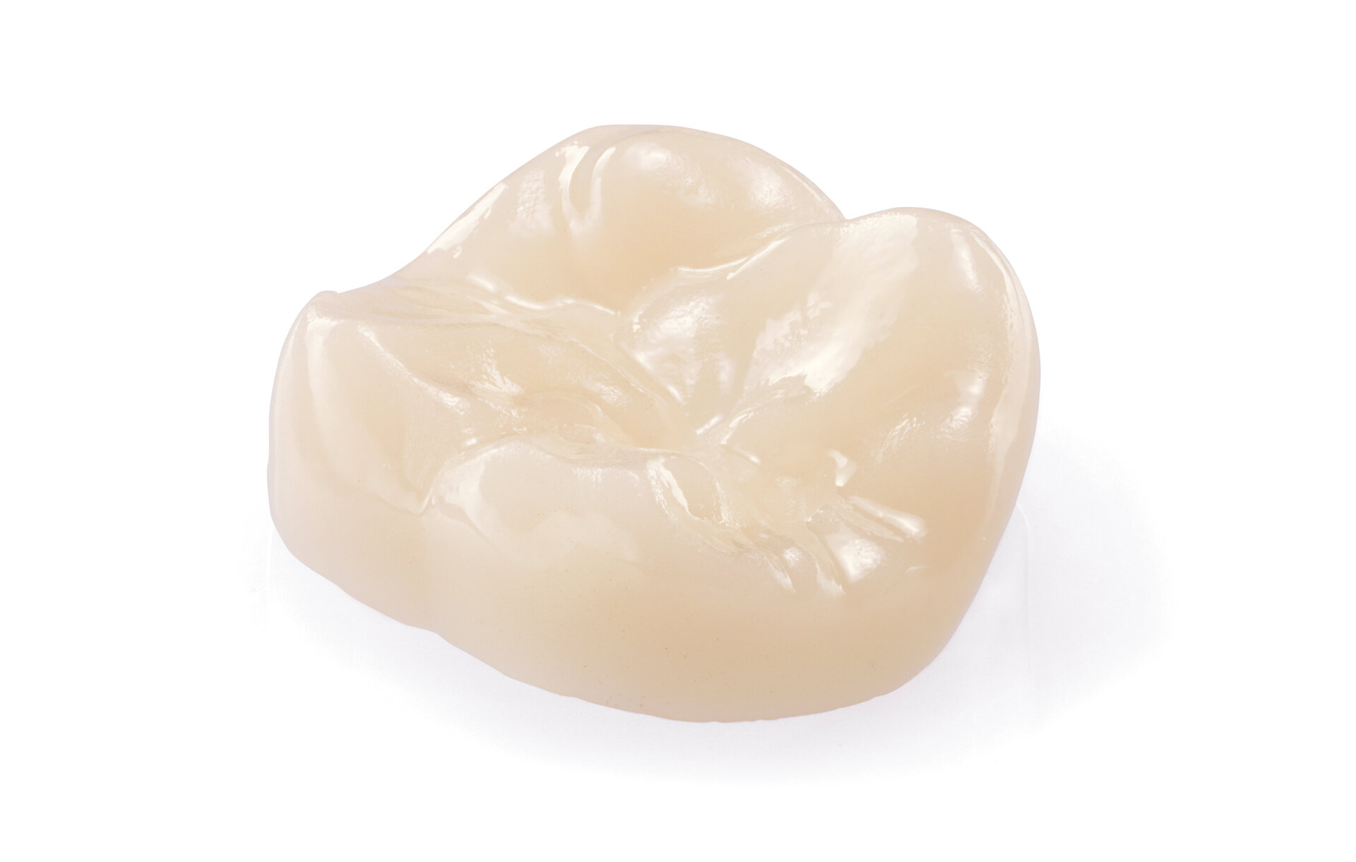 IPS e.max Press | Glass Ceramic Restorations | Ivoclar